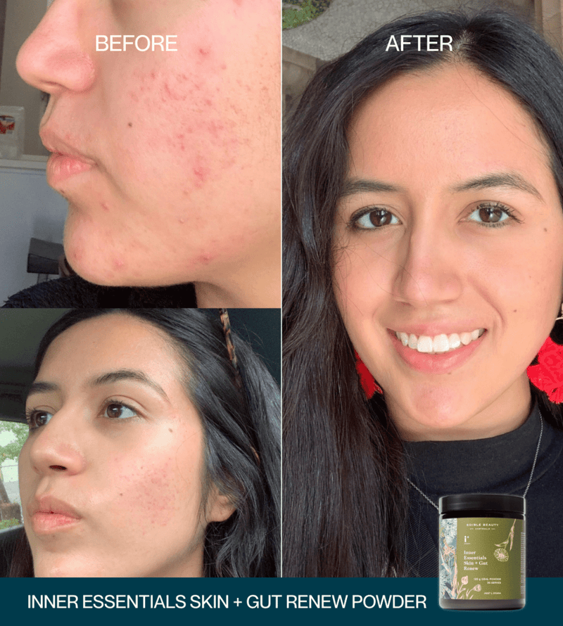 Inner Essentials – Skin + Gut Renew Powder – Edible Beauty Australia