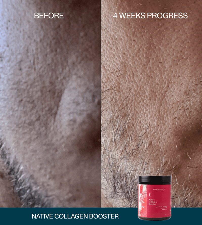 Native Collagen Booster | Pure & Vegan Collagen Powder – Edible Beauty ...